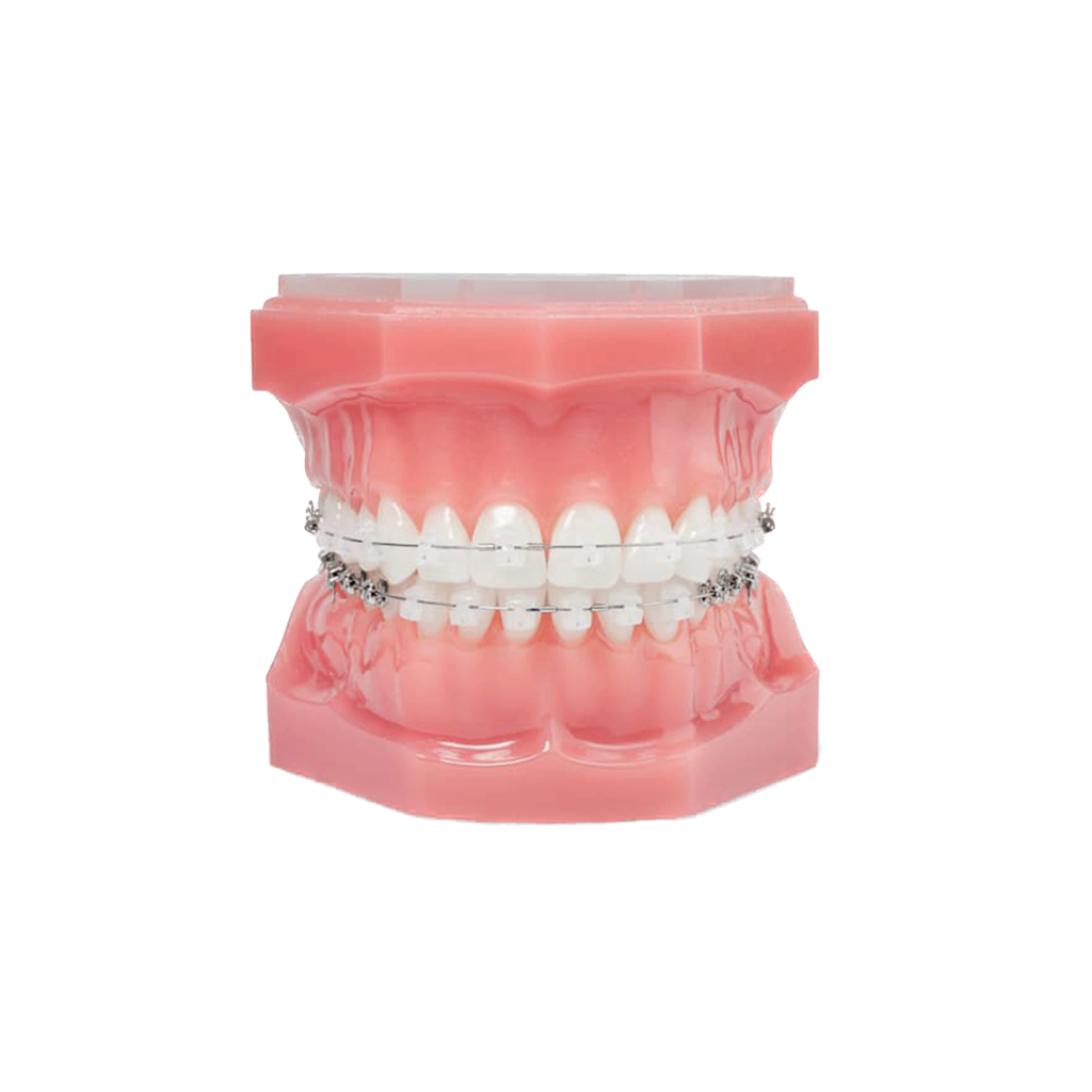 Top Braces in Norwich, CT | OASECT