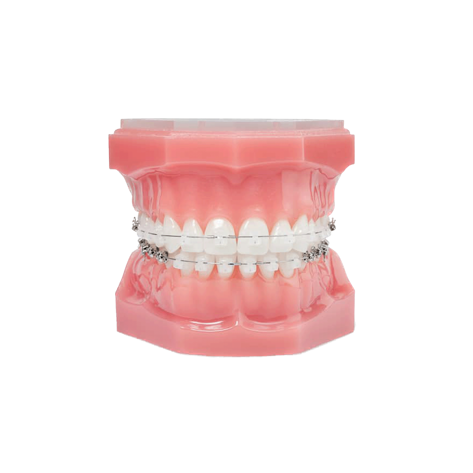 Get Braces in Norwich & Start Smiling